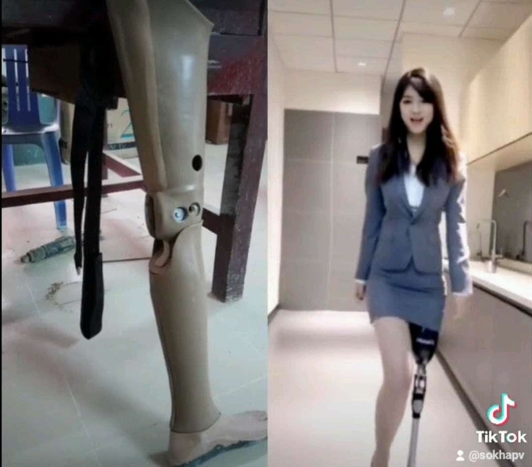 ជើងសម្បន្និមិត ប្រើសម្រាប់ អ្នកដែលដាច់ជើងលើ ជង្គង់ - TNAOT